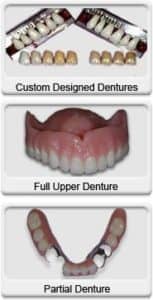 Custom Designed Dentures - Ocotillo Dental Care | Dentist Chandler, AZ